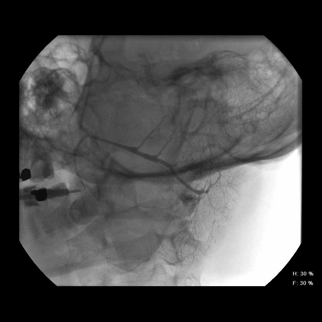 Salivary Gland Terminology (Anatomy, Salivation, Dry Mouth, Drooling ...