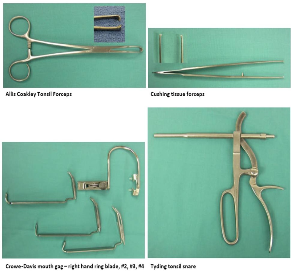 Tonsillectomy and Adenoidectomy | Iowa Head and Neck Protocols - Carver ...