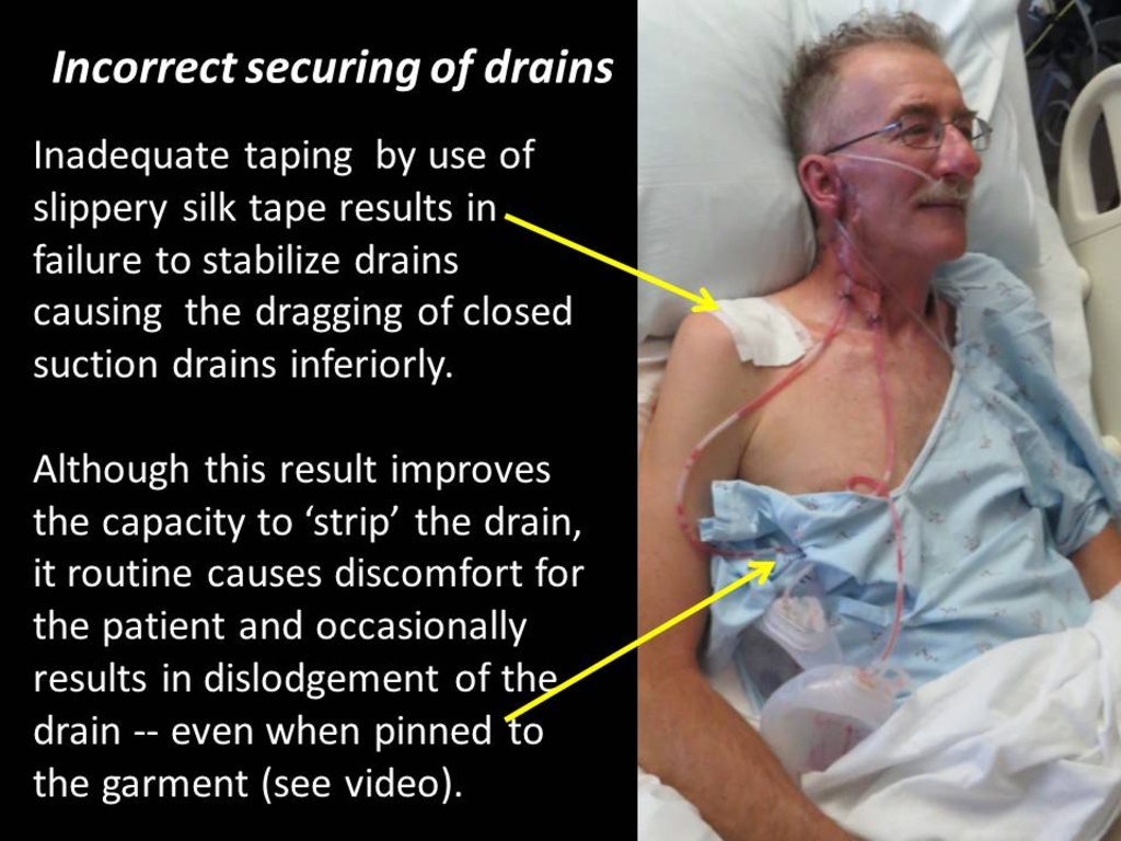 Closed Suction Drain Management - Securing the Drain | Iowa Head and ...