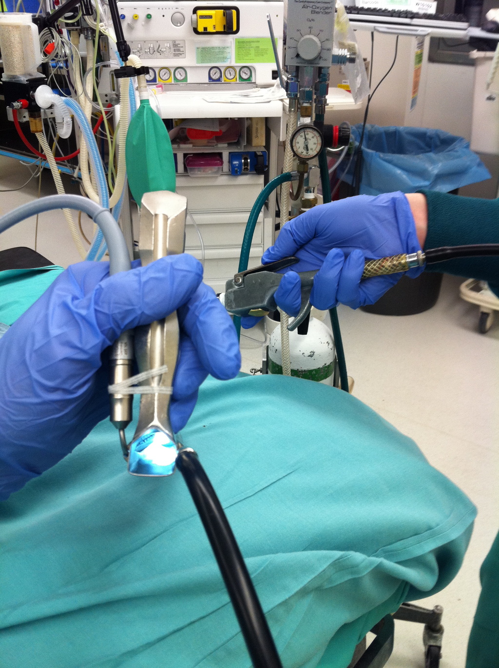 Jet Ventilation Anesthesia - Transoral for Laryngeal Surgery | Iowa ...