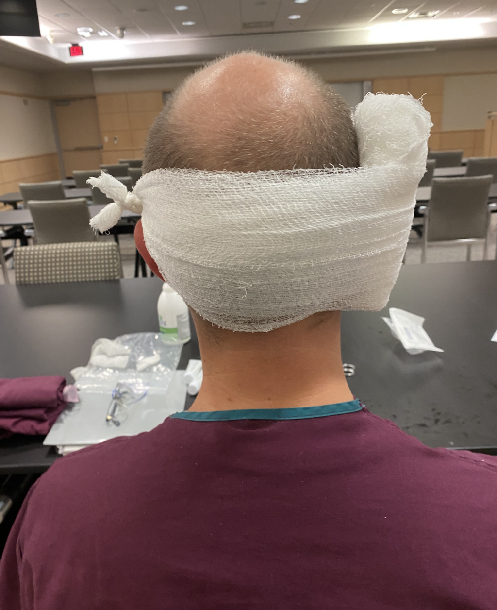 How to Apply Mastoid Dressing - Illustrated Steps | Iowa Head and Neck ...