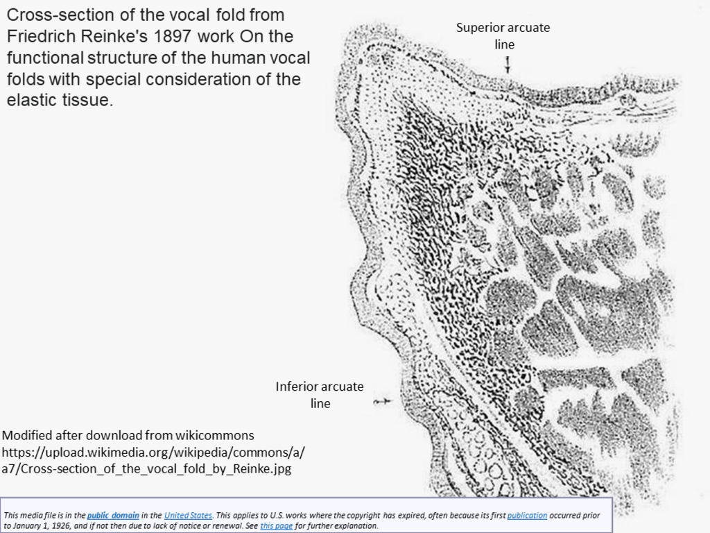 Vocal Fold Hemorrhage, Vocal Cord Bleed, Vocal Varix, Telangiectasia ...