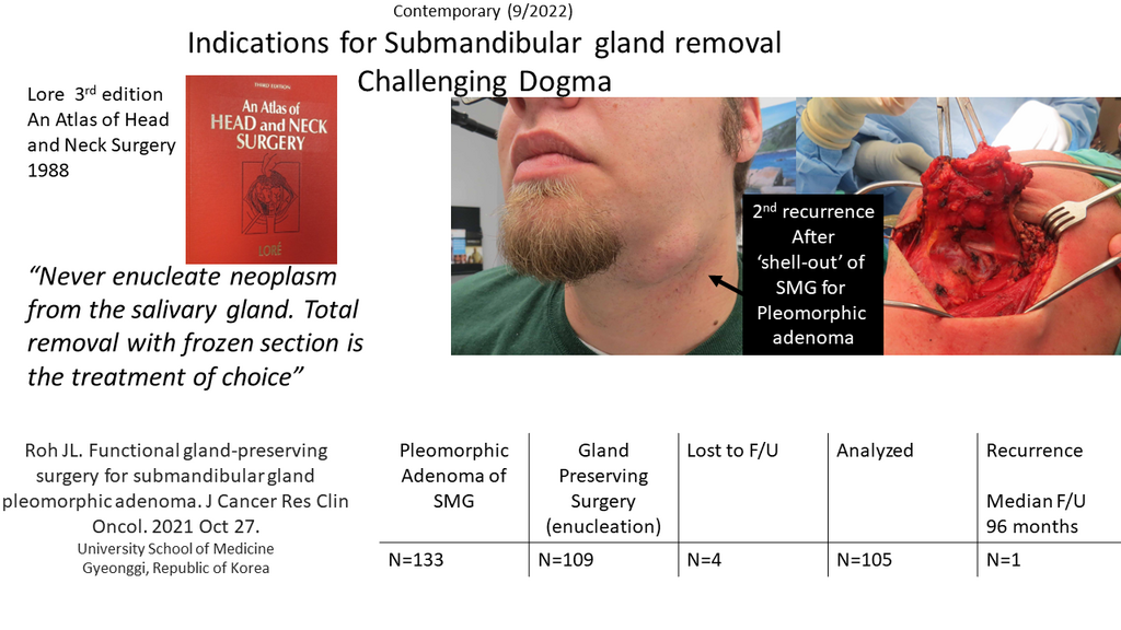 Submandibular Gland Resection/Excision | Iowa Head and Neck Protocols ...