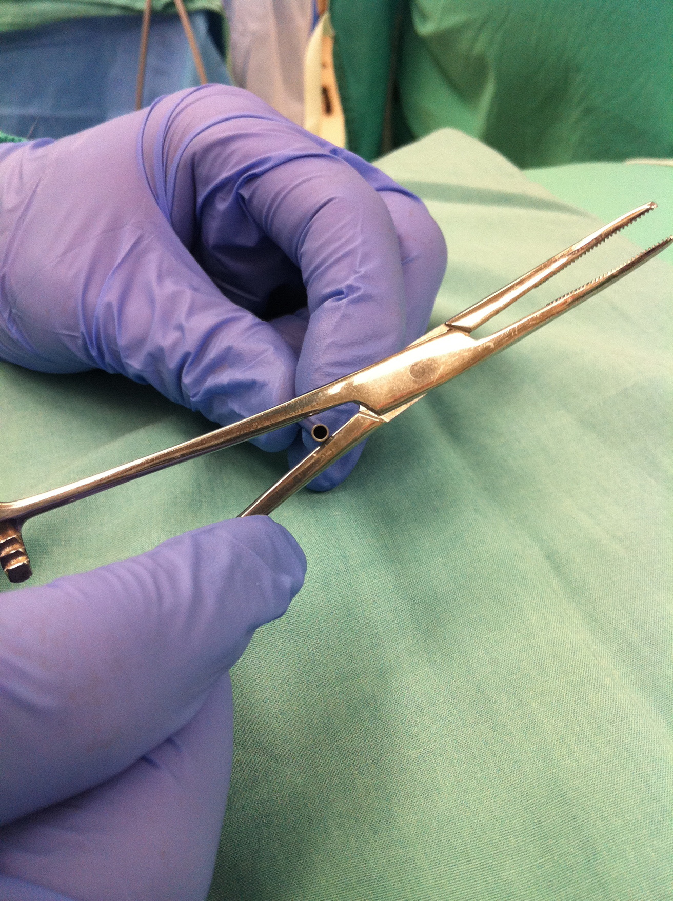 Jet Ventilation Anesthesia - Transoral for Laryngeal Surgery | Iowa ...