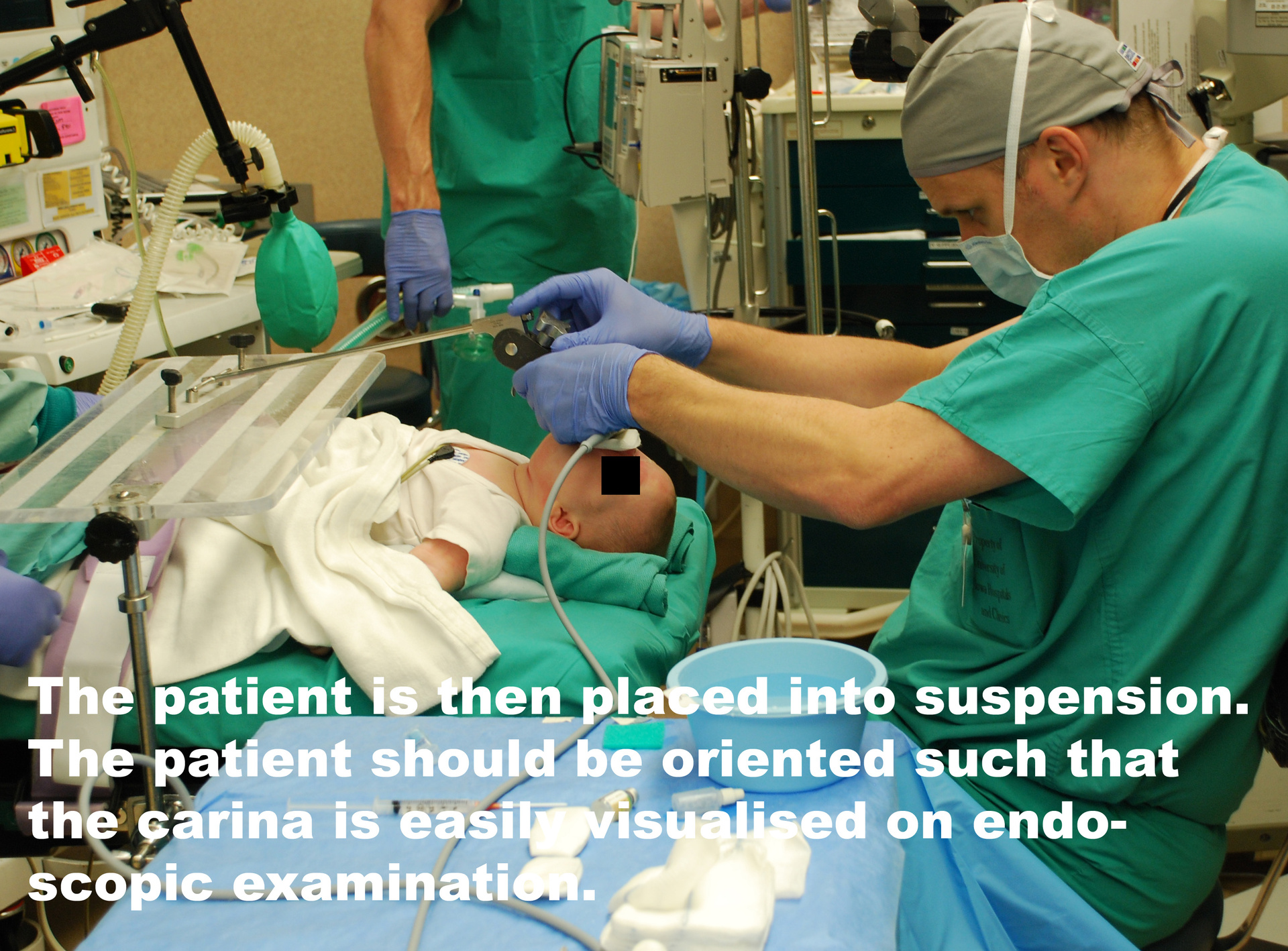 Pediatric Direct Laryngoscopy | Iowa Head and Neck Protocols - Carver ...