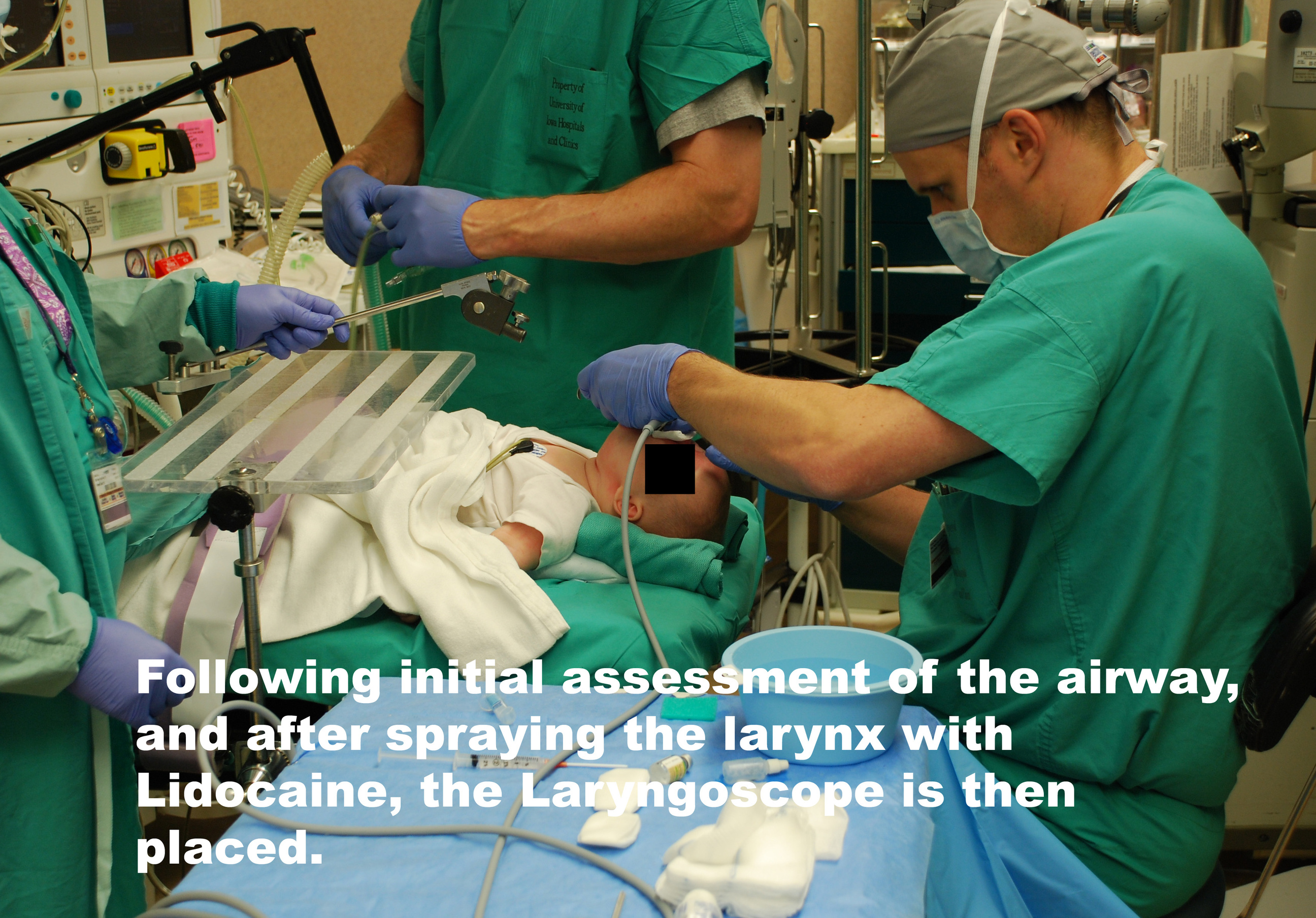 Pediatric Direct Laryngoscopy | Iowa Head and Neck Protocols - Carver ...