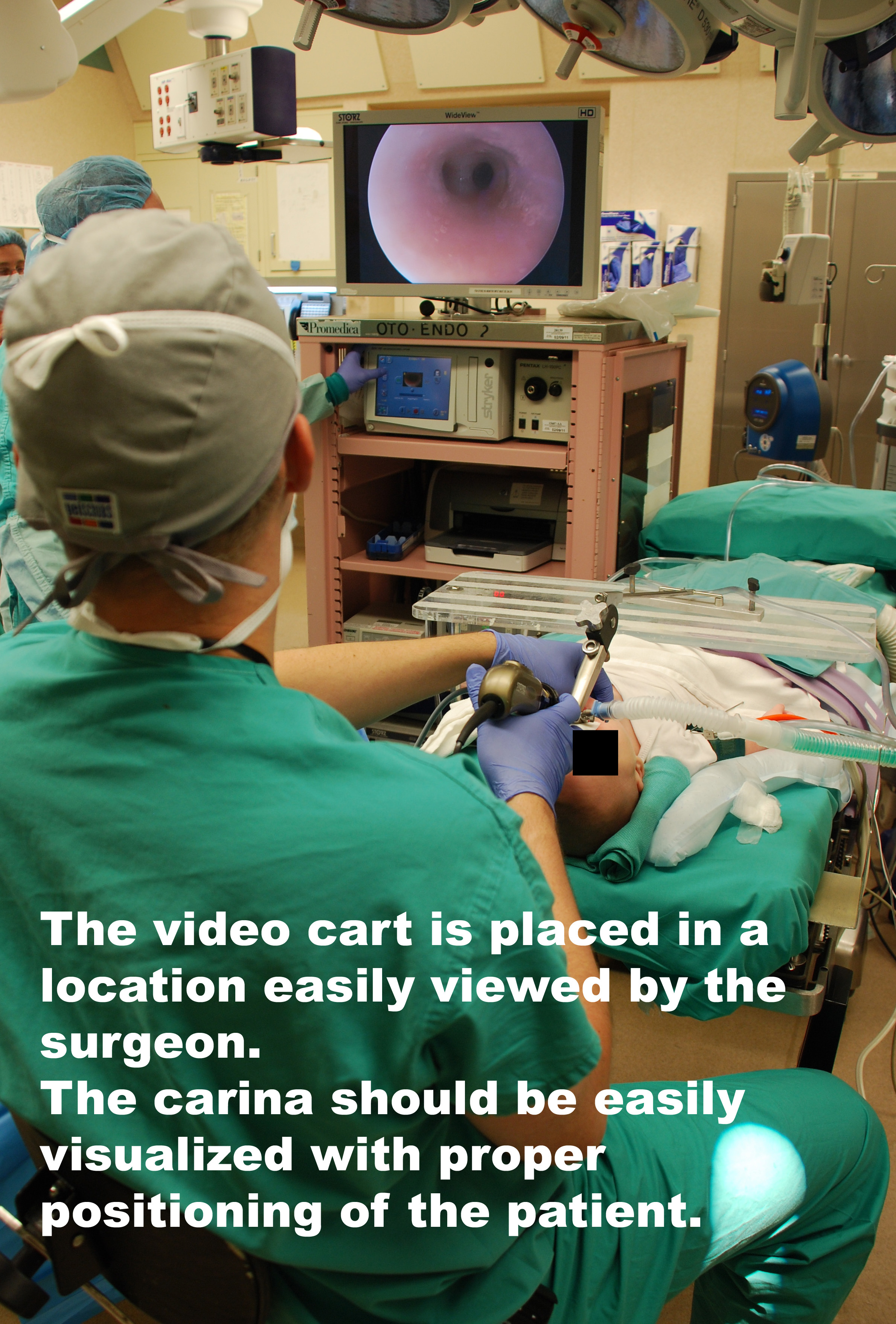 Pediatric Direct Laryngoscopy | Iowa Head and Neck Protocols - Carver ...