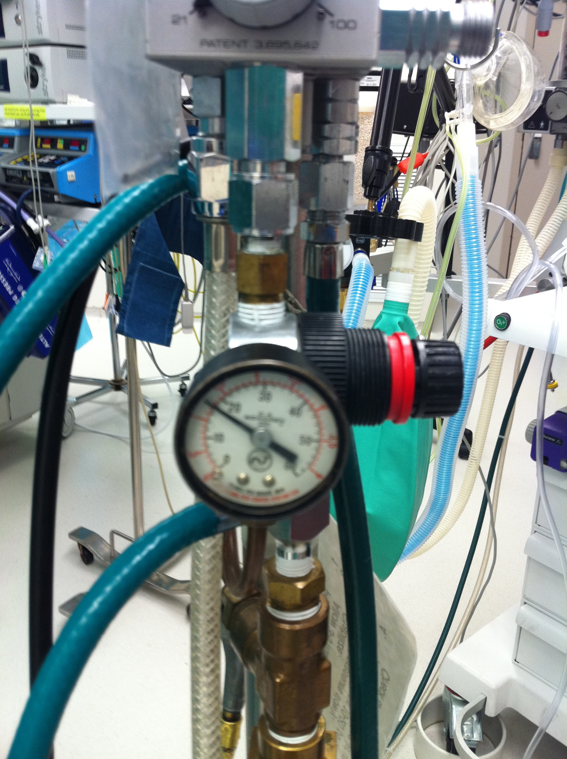 Jet Ventilation Anesthesia - Transoral for Laryngeal Surgery | Iowa ...