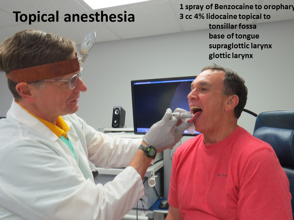 Vocal Cord Injection with Prolaryn Gel with Videostroboscopy (Transoral ...