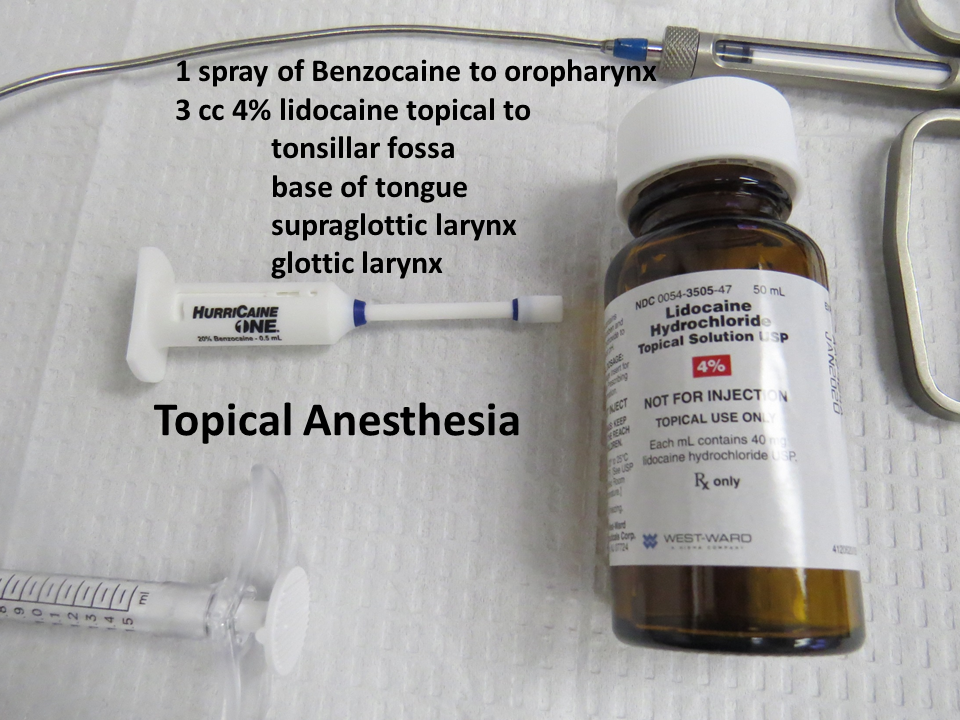 Vocal Cord Injection with Prolaryn Gel with Videostroboscopy (Transoral ...