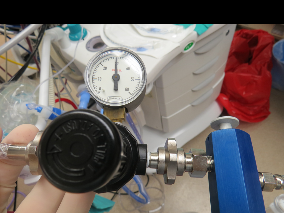 Jet Ventilation Anesthesia - Transoral for Laryngeal Surgery | Iowa ...