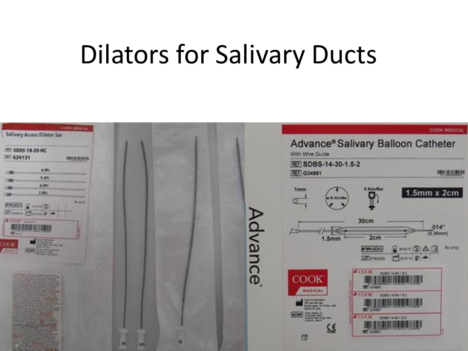 Salivary Stent for Parotid Duct Stricture with Parotid Stone ...