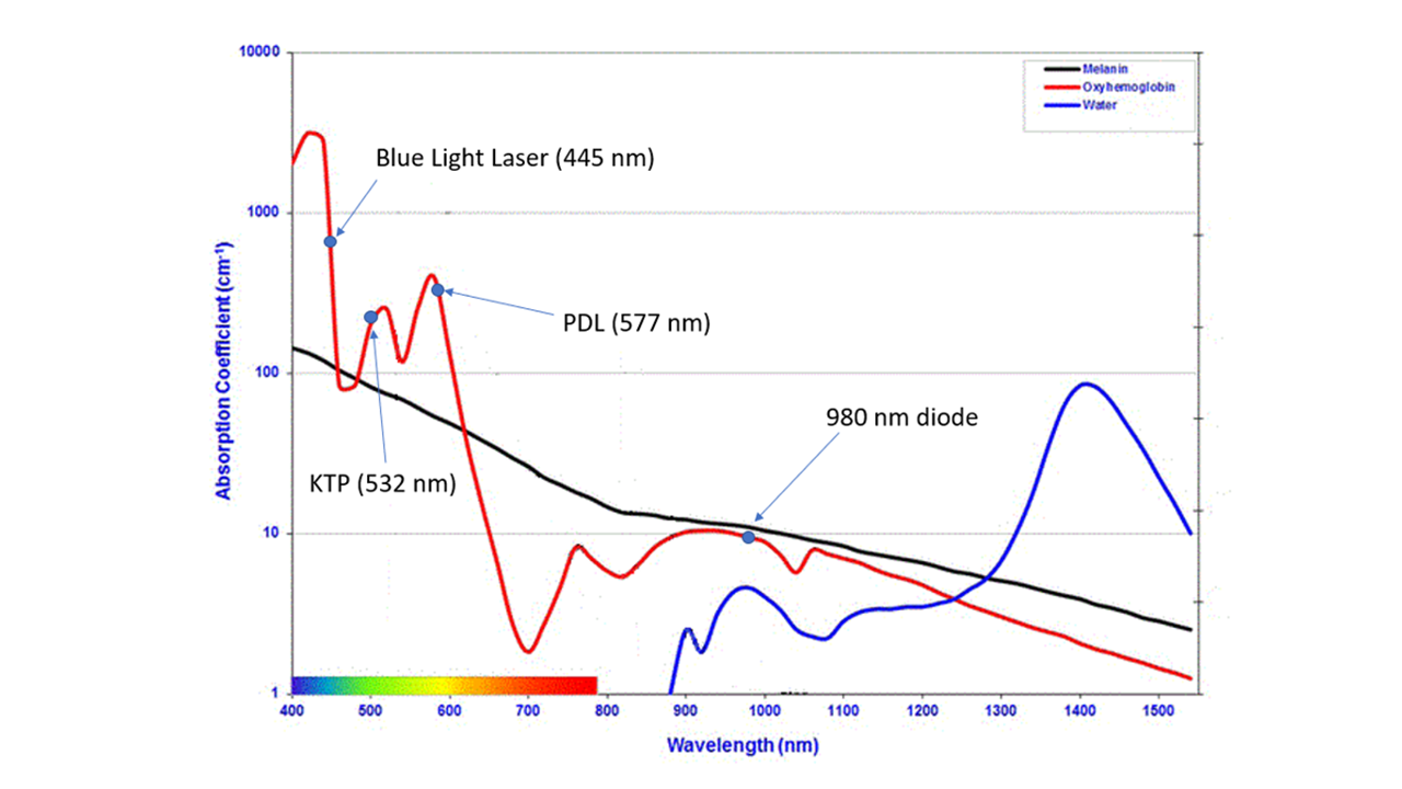 Blue Light Laser (445 nm Wavelength) - Settings, Application, and ...