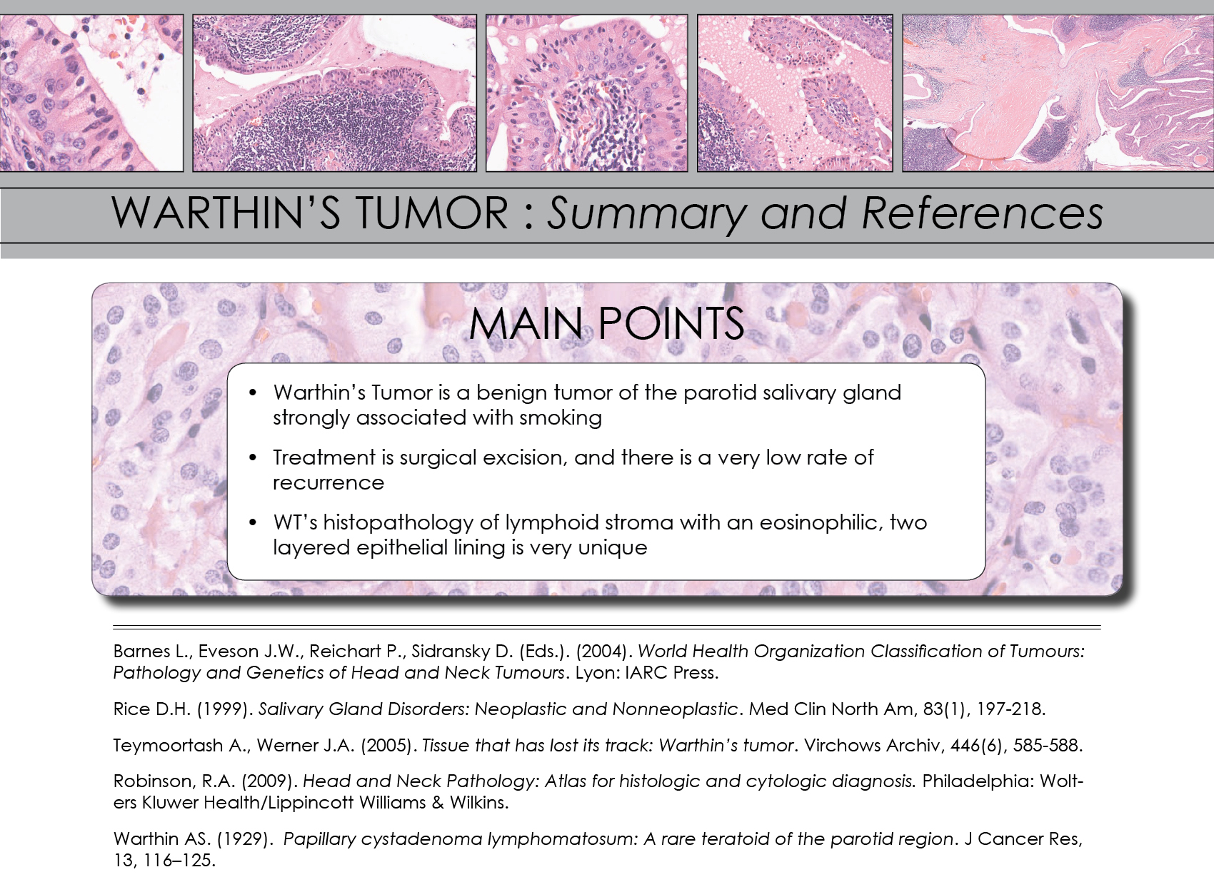 Pathology of Warthin's Tumor | Iowa Head and Neck Protocols - Carver ...