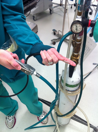 Jet Ventilation Anesthesia - Transoral for Laryngeal Surgery | Iowa ...