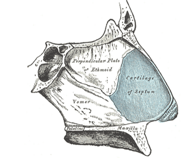Septoplasty For Nasal Obstruction Indications and Techniques | Iowa ...
