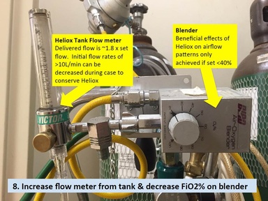 Heliox Setup for the Difficult Airway | Iowa Head and Neck Protocols ...