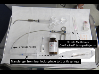 Vocal Cord Injection with Prolaryn Gel with Videostroboscopy (Transoral ...